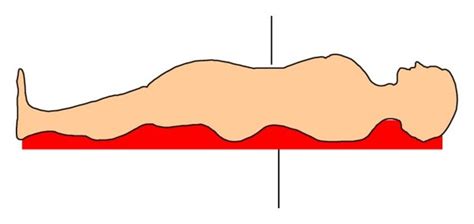 The Symmetric A And Asymmetric B Electrode Arrangement The Download Scientific Diagram