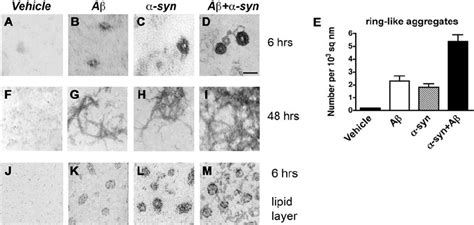 Electron Microscopy Analysis Of Hybrid Oligomers And Fibrils Of A B And Download Scientific