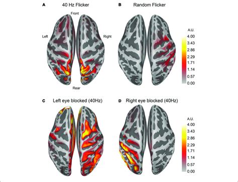 Altered Cortical Responses In Response To 40 Hz Light Flicker