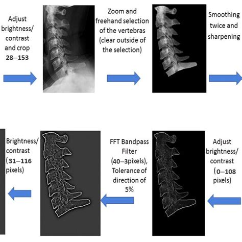 Features Extraction Using The Glcm Method Applied To The Necks X Ray