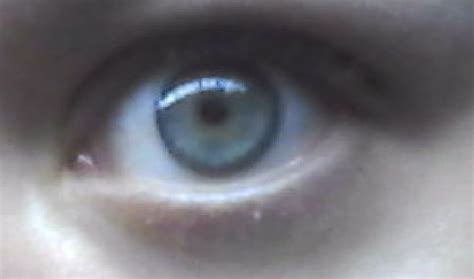 Blue Eyes With Brown Ring Around Pupil