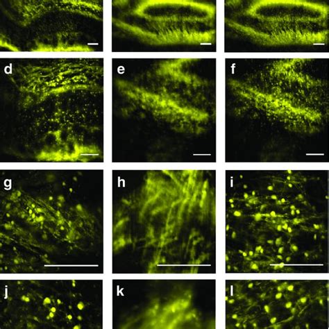 First Order Defocus Correction Images Were Acquired Using A−c ×4 Na Download Scientific