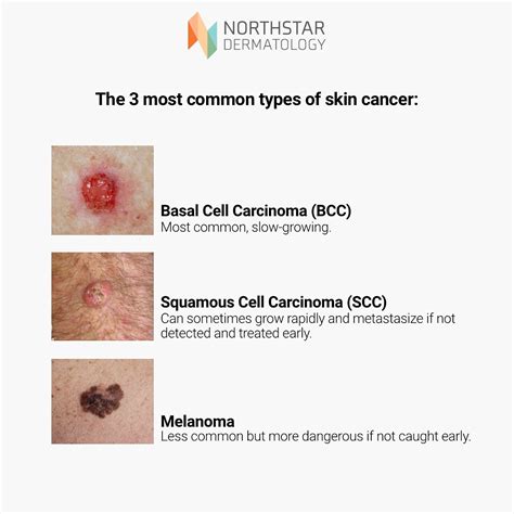 Northstar Dermatology Added A New Northstar Dermatology