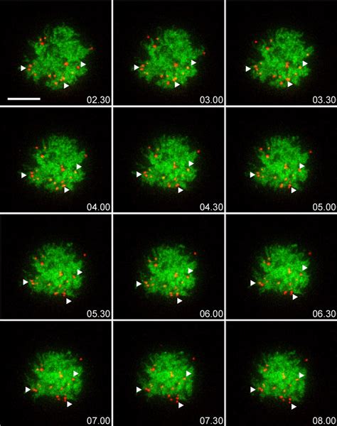 Pml Nb Dynamics Upon Calyculin A Induced Premature Chromosome