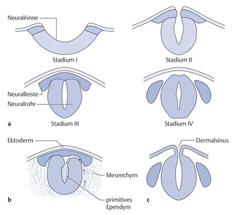 Secondary Neurulation
