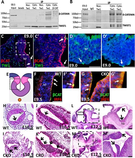 Twist1 Interaction With βδ Catenin Proteins Ab The In Vivo