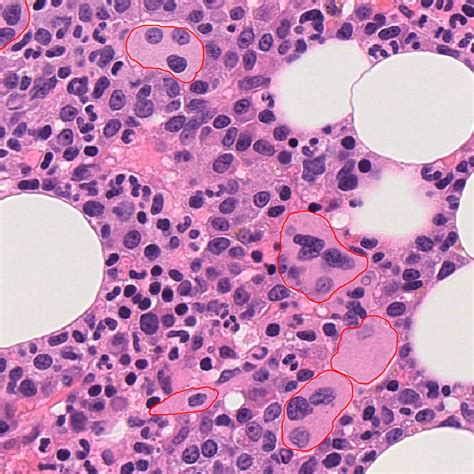 cellpose on megakaryocytes image analysis image sc forum