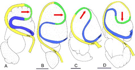 Intestinal Loops Of Type I Small Black Arrows Show The Direction Of Download Scientific