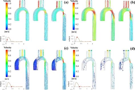 Streamlines In The Right Anterior View At A Mid Systole B Peak