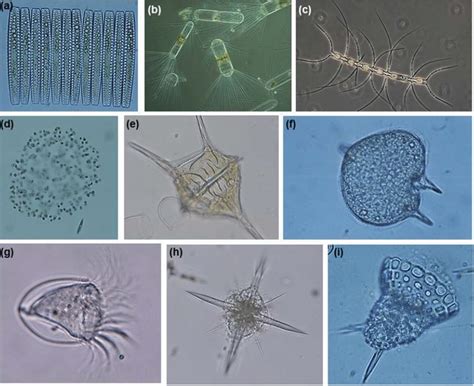 Microscopic Pictures Of Southern Ocean Protists The Diatoms Download Scientific Diagram