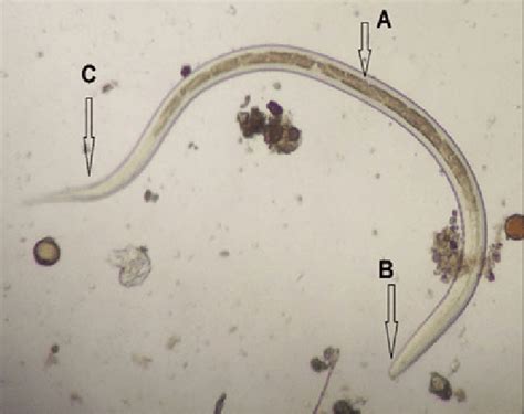 Picture Of Infective Larva L 3 Of Trichostrongylus Spp Download