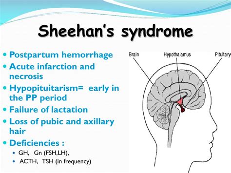 Ppt Disorders Of Menstrual Function Neuroendocrine Syndromes In