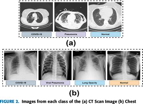 Figure 2 From Fast And Efficient Lung Abnormality Identification With Explainable Ai A