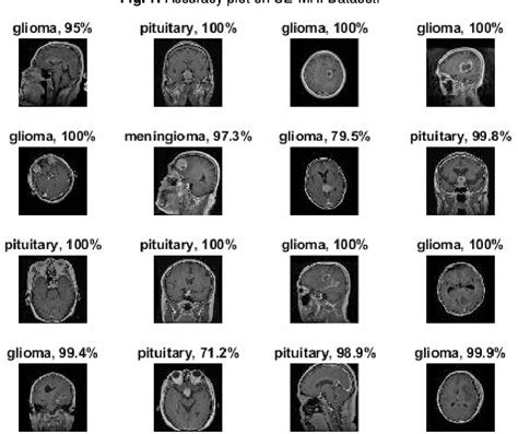 Figure 8 From Multi Tumor Classification In Mr Brain Images Through