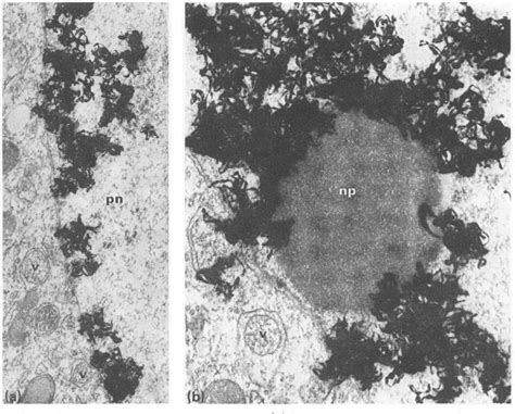 Table 1 From Nucleic Acid Synthesis And Development Of Human Male Pronucleus Semantic Scholar