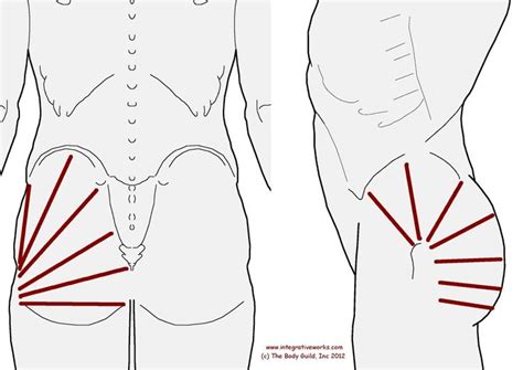 Self Care Releasing Hip Trigger Points With A Tennis Ball