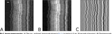 Figure 1 From A Fast And Scalable Kymograph Alignment Algorithm For