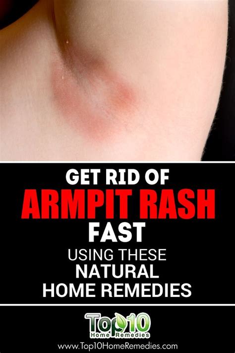 How To Treat Itchy Rash On Armpit at Lois Lumpkin blog
