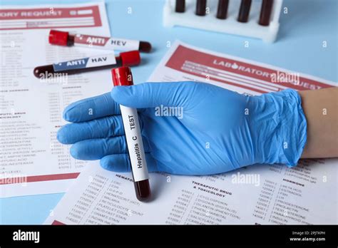 Scientist Holding Tube With Blood Sample And Label Hepatitis C Test Near Laboratory Form