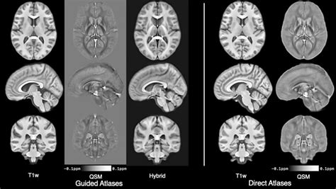 Qualitative Comparison Of The Hybrid Guided Atlases Guided Atlases Download Scientific