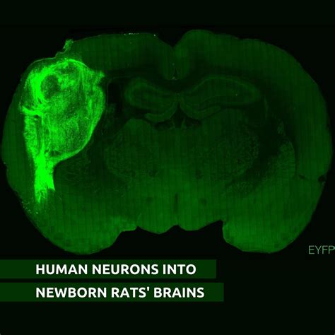 Asuman Celik On Linkedin Humanbody Brain Tissueengineering