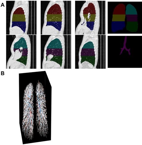 An Example Of Vascular Reconstruction Quality Check Outputs A Depicts Download Scientific