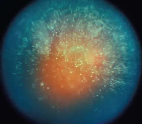 20202021 Bcsc Basic And Clinical Science Course™