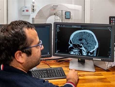 Ct Low Dose Ct Scans Bulk Billing Available