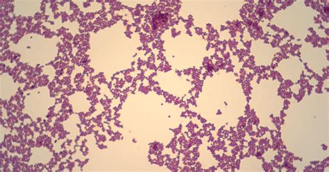 Microbiology Concepts Acinetobacter And Others