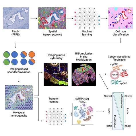 Panin And Caf Transitions In Pancreatic Carcinogenesis Revealed With