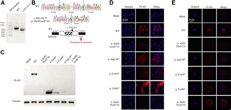 Effects Of The Lof Variants On Nuclear Localization In Hela Cells And Download Scientific