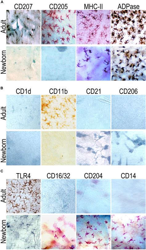 Frontiers Langerhans Cells From Mice At Birth Express Endocytic And