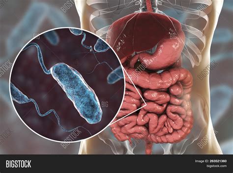 Vibrio Cholerae Pronunciation