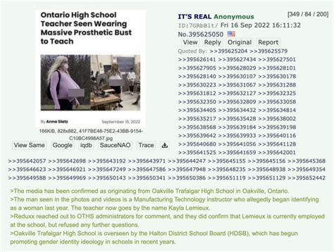 Ontario High School Teacher Kayla Lemieuxs Prosthetic Boobs