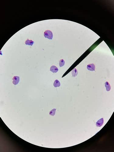 Protozoa Lab Flashcards Quizlet