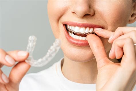Invisible Braces Explained What Are Their Benefits
