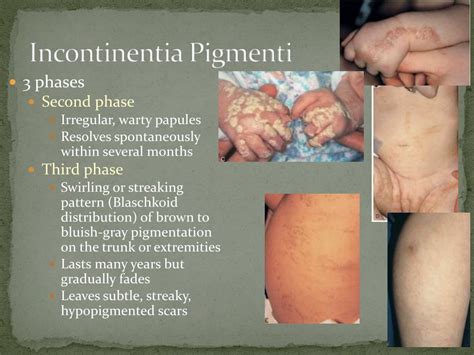 Ppt Other Infantile Rashes Powerpoint Presentation Free Download