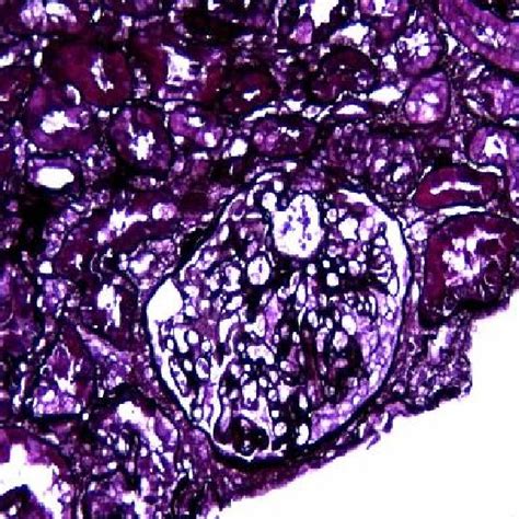 Light Microscopy Showing Normal Glomeruli Download Scientific Diagram