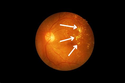 Modern Vision Care Dont Lose Sight