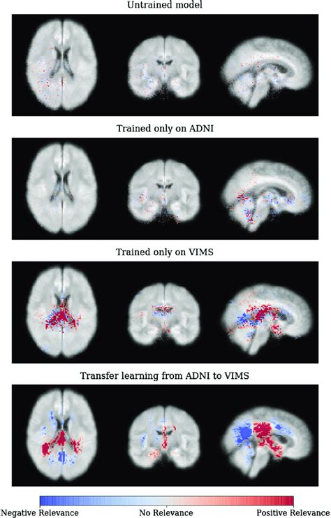 Average Heatmaps For Different Cnn Models Applied To The Ms Vims Download Scientific Diagram