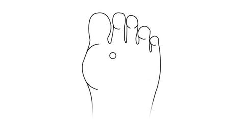 Managing Pain And Discomfort After Ingrown Toenail Surgery
