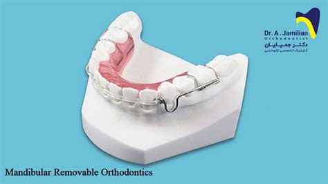Orthodontic Removable Device At Edith Erdman Blog