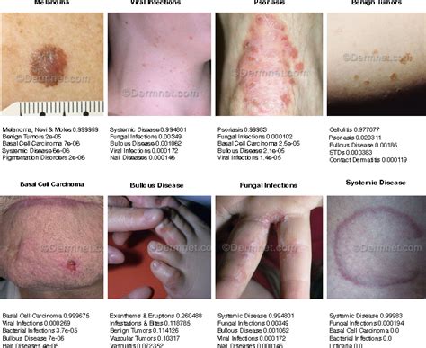 Pdf A Deep Learning Approach To Universal Skin Disease Classification