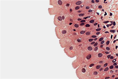 Collecting Duct Physiology Question Practice Question Solving Entermedschool Future