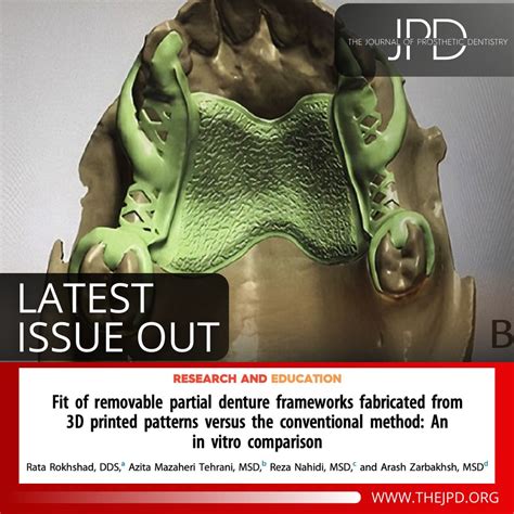 How Removable Partial Denture Frameworks Differ The Journal Of