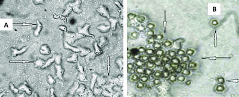 Photomicrograph Of Acanthamoeba Trophozoites A And Cysts B With