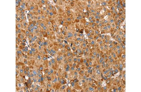 Anti Ssbp1 Antibody A38208