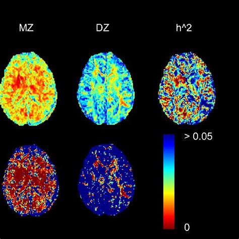 Top And Bottom Left Multivariate Intraclass Correlation Orientation Download Scientific