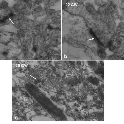 Electronmicrographs Show The Morphology Of Synapse Arrow During Download Scientific Diagram