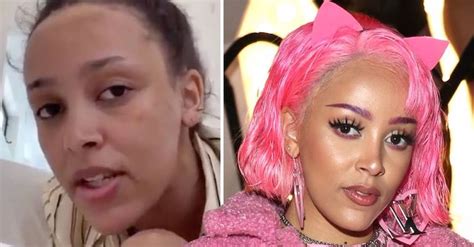Top 60 Berühmtheiten Ohne Make Up Vorher And Nachher Seite 12 Von 59
